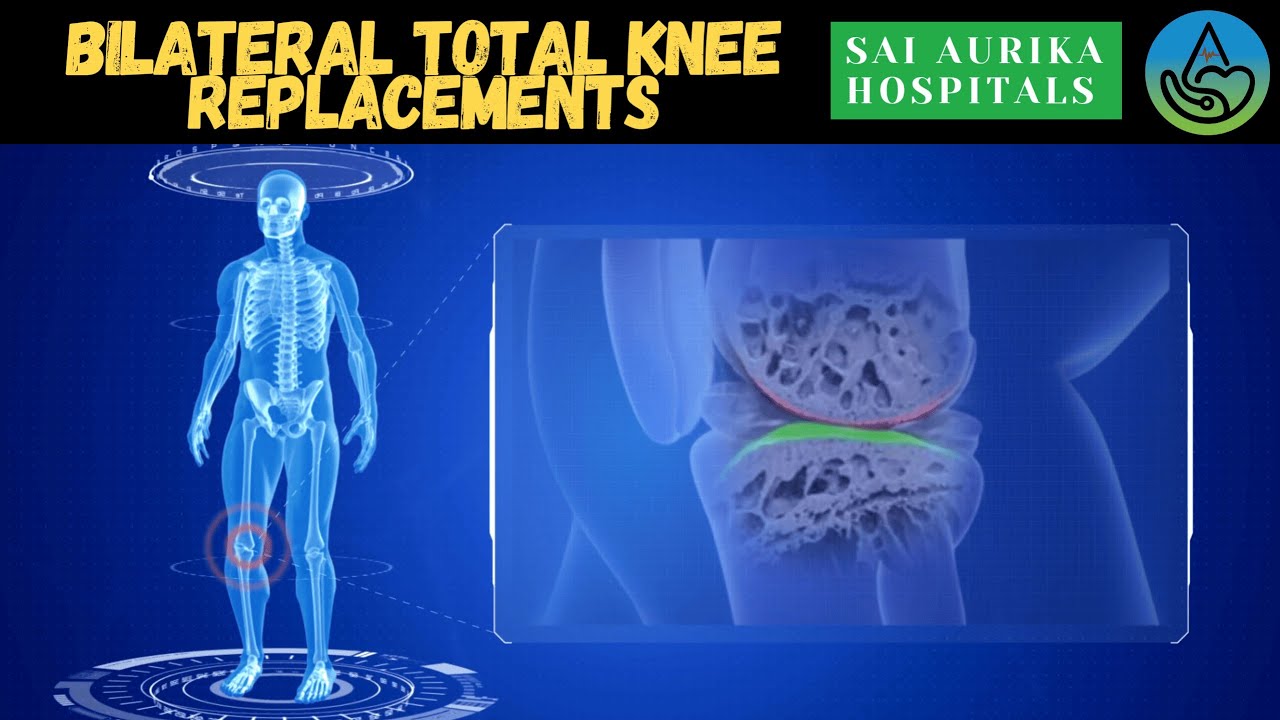 Testimonial of a Bilateral Knee Replacements Patient - YouTube