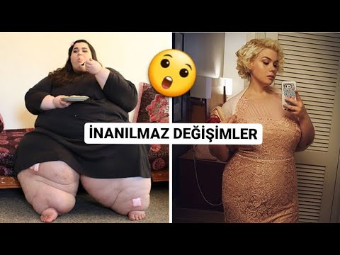 AĞIR YAŞAMLARA KATILANLARIN İNANILMAZ DEĞİŞİMİ