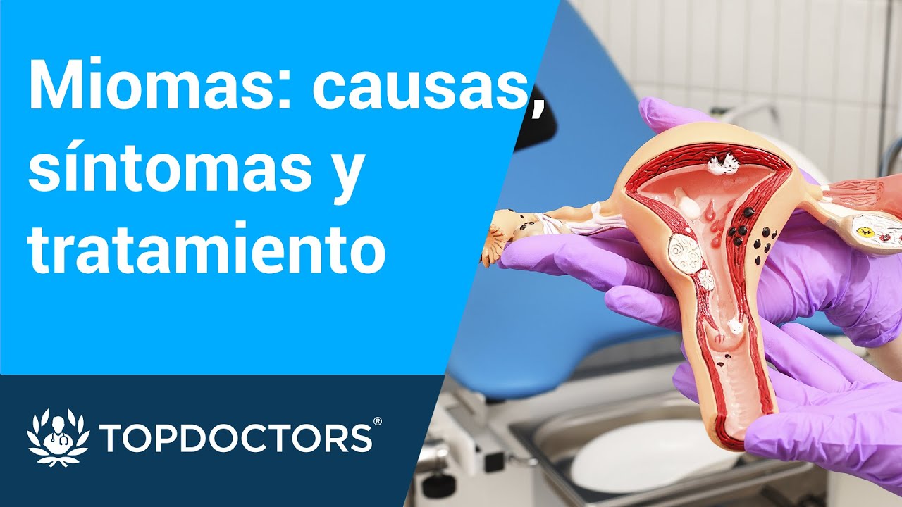 Miomas: causas, síntomas y tratamiento - YouTube