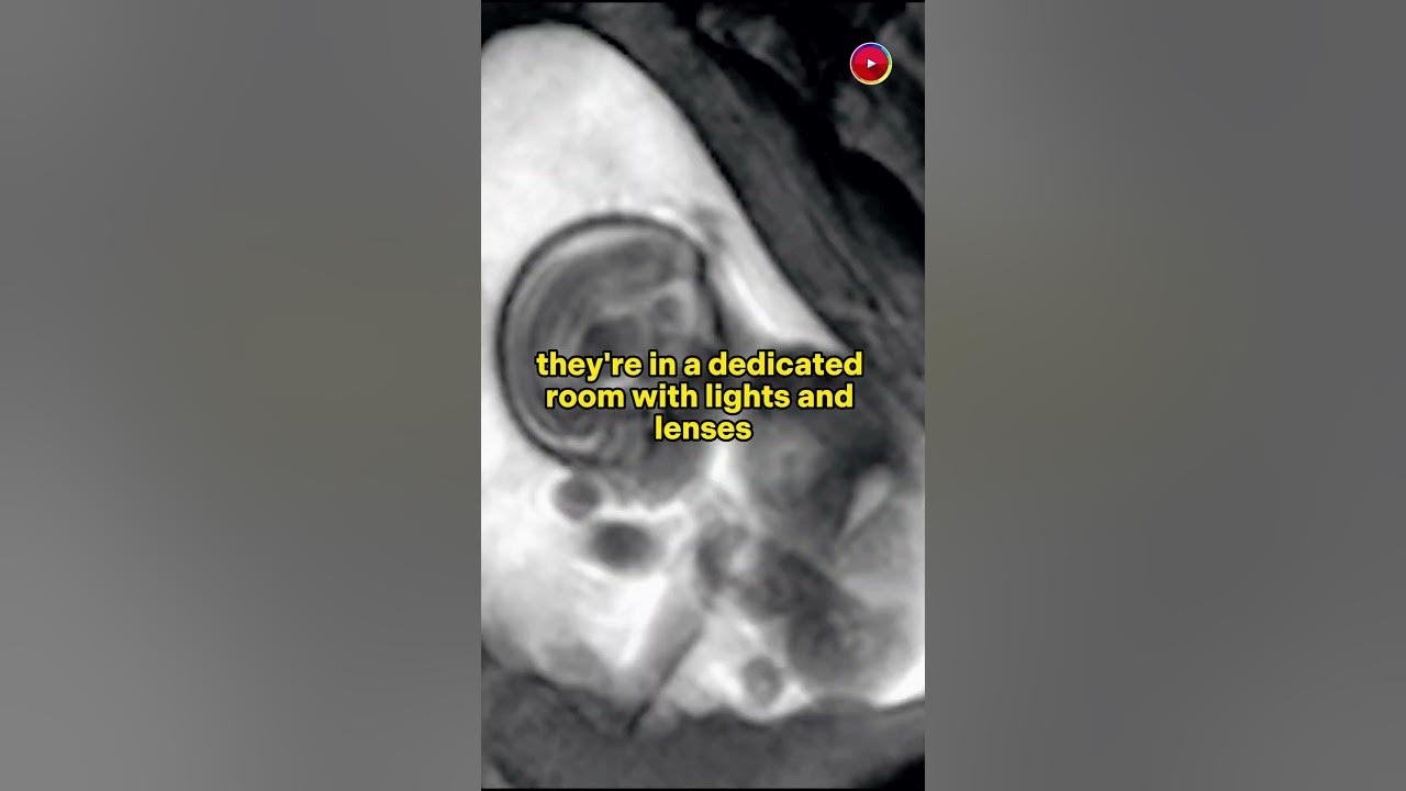 Fetus 18 Weeks 1965 Historical Pictures #shorts - YouTube