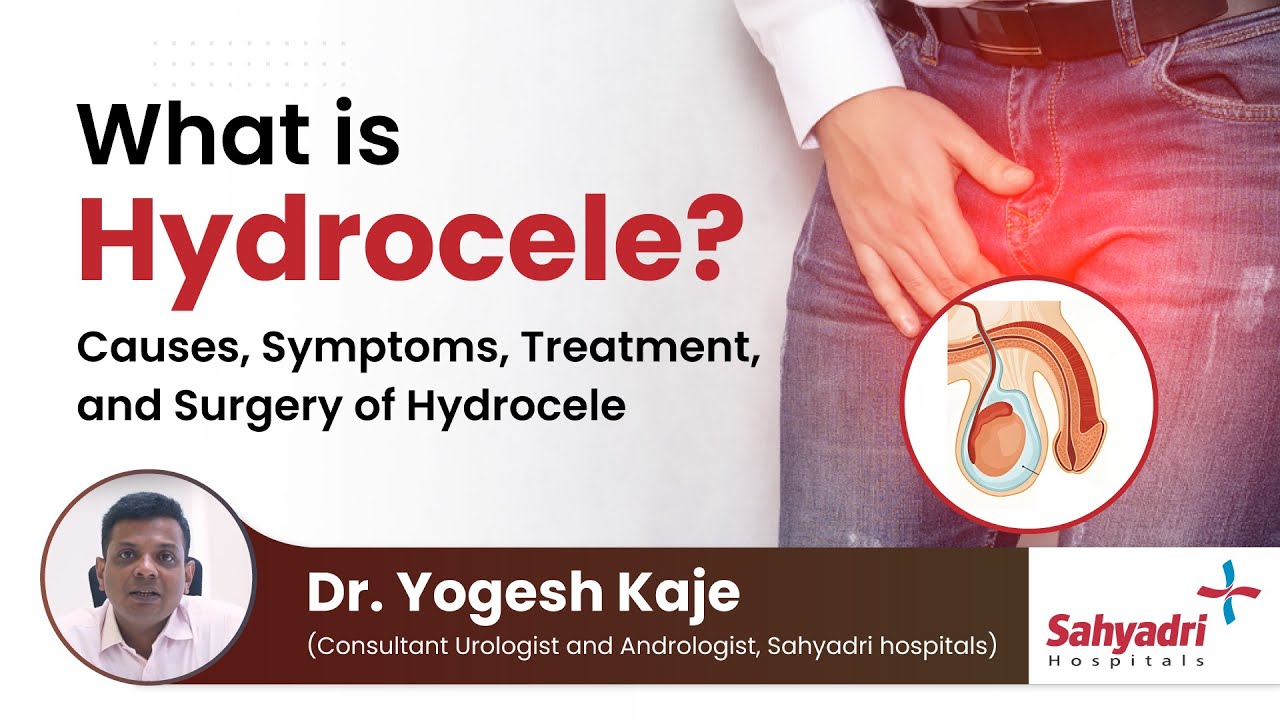 What is Hydrocele? | Causes, Symptoms, Treatment, and Surgery of ...