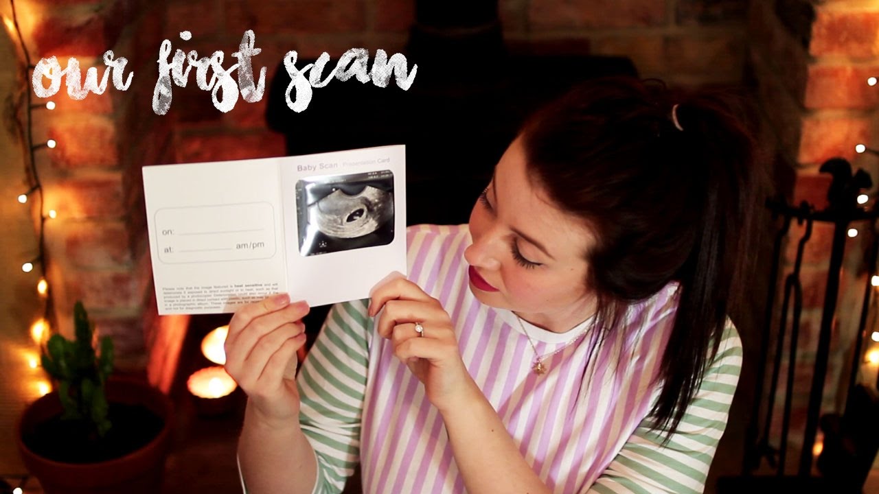 OUR FIRST SCAN | PREGNANCY AFTER INFERTILITY & MISCARRIAGE | ONCE IN A ...
