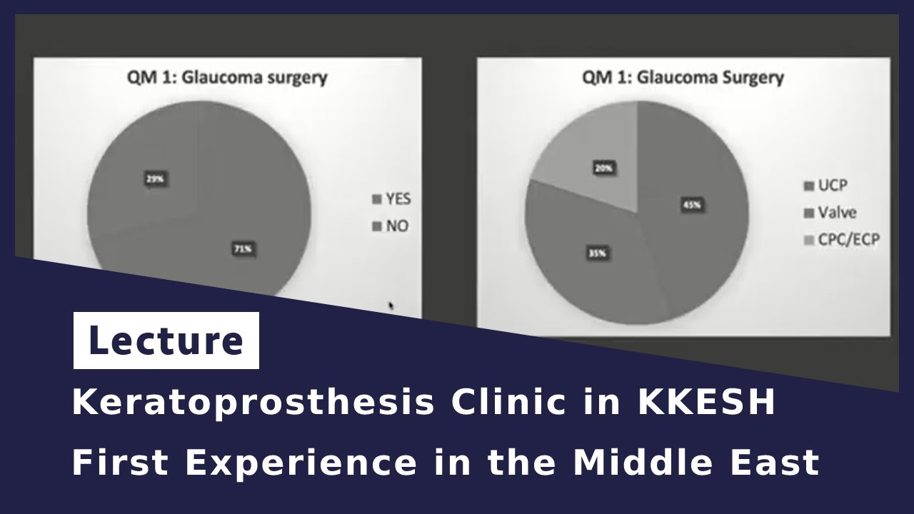 Keratoprosthesis Clinic in KKESH First Experience in the Middle East ...