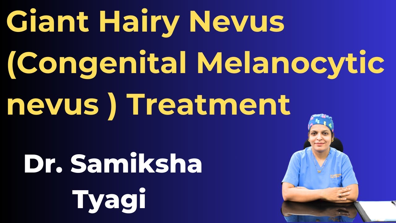 Giant Hairy Nevus ( Congenital Melanocytic nevus ) Treatment Giant ...