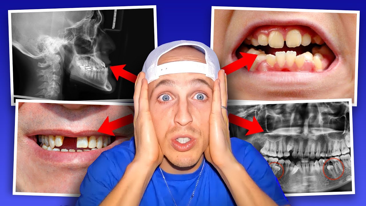Hereditary Dental Problems that Cost A LOT OF MONEY [ask this] - YouTube