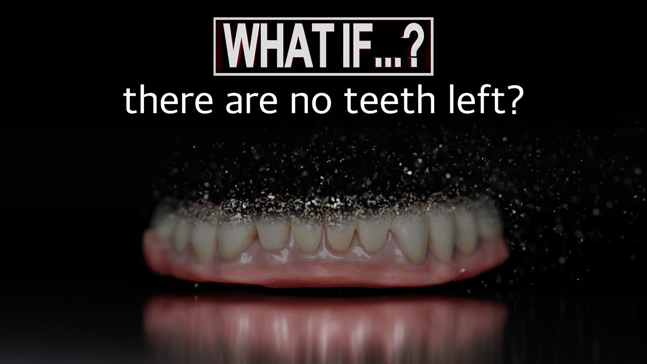 What if you lost all your teeth? - YouTube