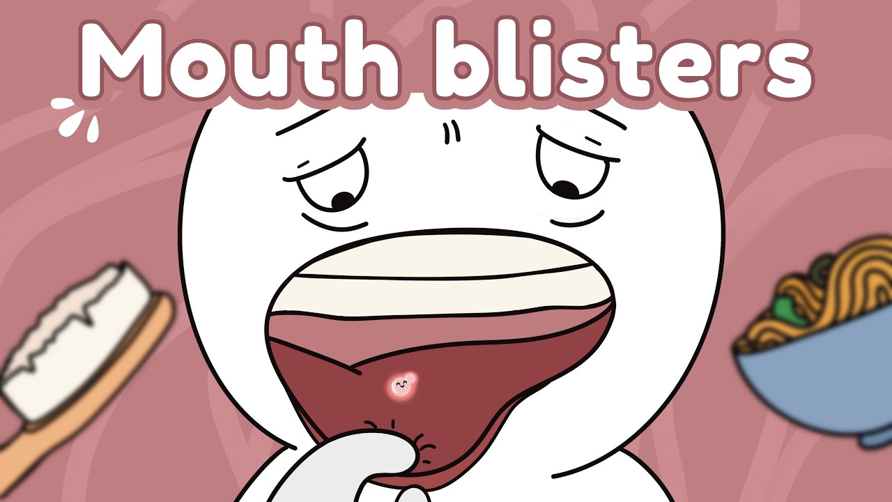 The Struggle of Mouth Blisters | Funny animation - YouTube