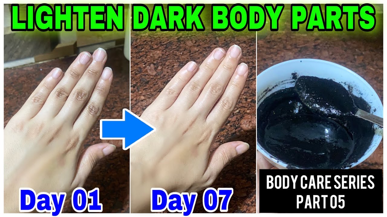 Lighten Your Private And Dark Body Parts In Just 7 Days | Dark Private ...