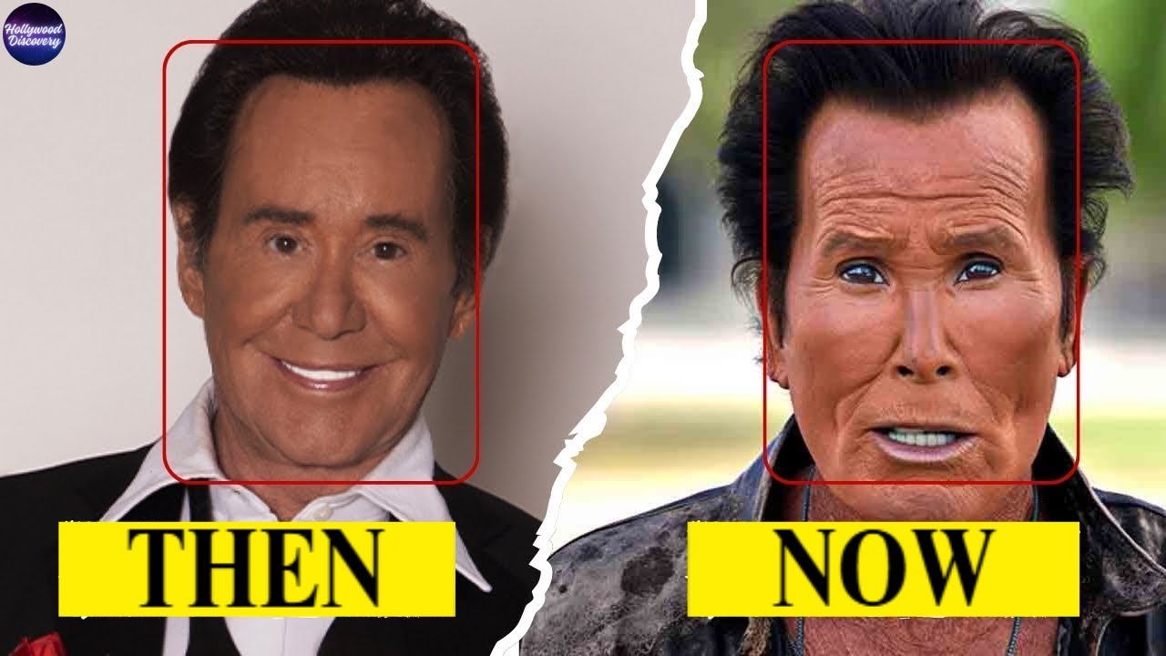 SHOCKING Male Plastic Surgery Transformations! | Then and Now 2025 ...