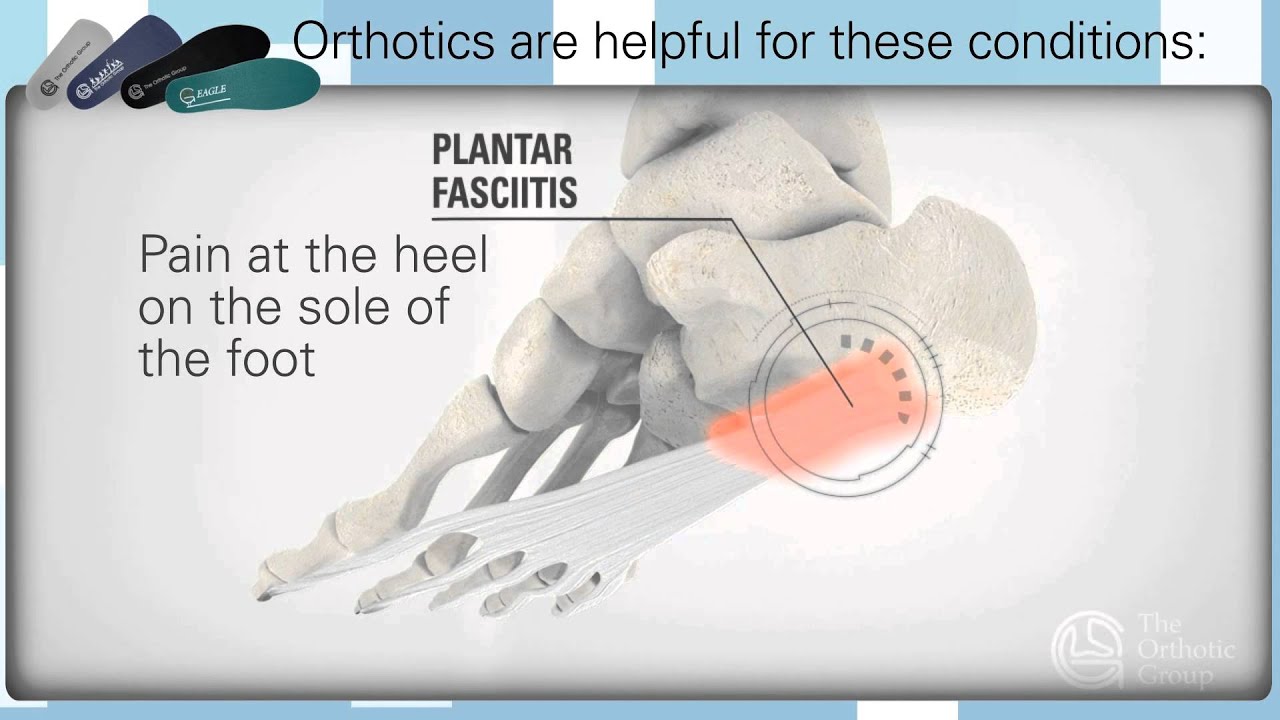 Lower extremity conditions explained - YouTube