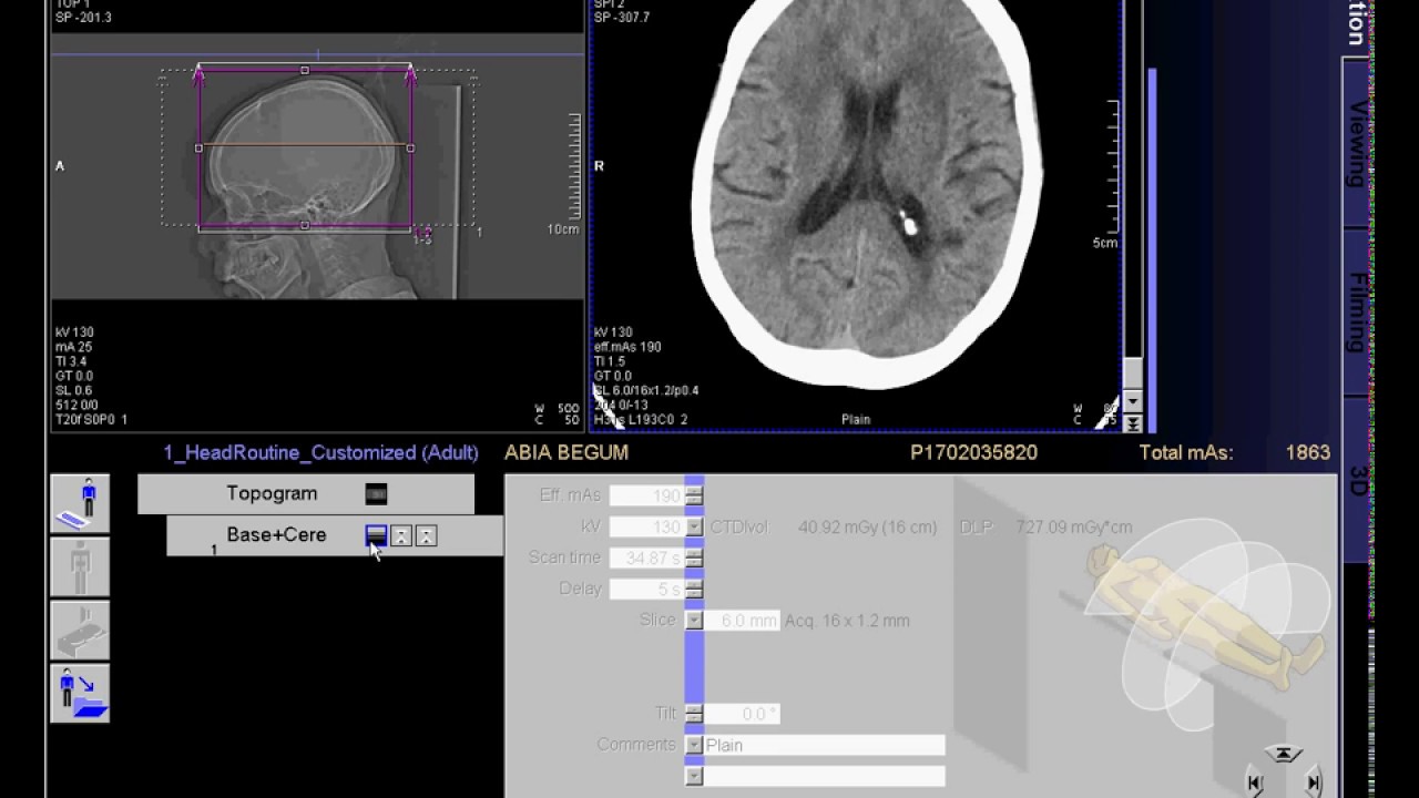 CT Scan of brain work process - YouTube