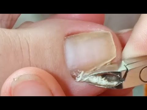 Khóe này khó thể cắt móng vuông được 😊 #laykhoemongchan #nails #xuhuongyoutube #nailart #travel 