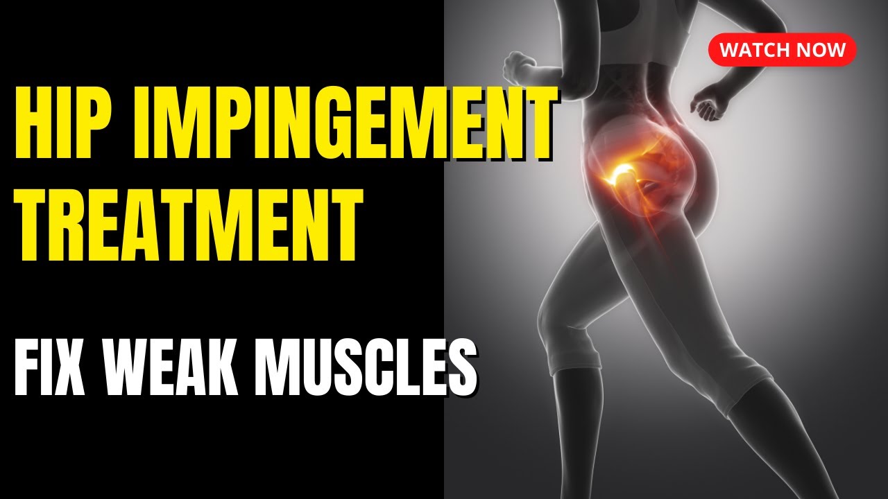 Hip Impingement Treatment - Fix Weak Muscles - YouTube