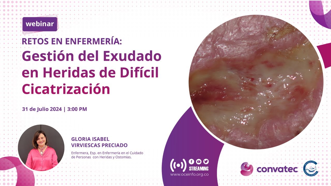 Gestión del Exudado en Heridas de Difícil Cicatrización. - YouTube