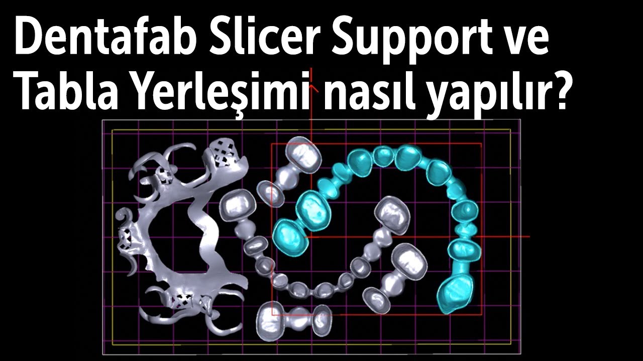 Dentafab Slicer Support ve Tabla Yerleşimi nasıl yapılır? - YouTube