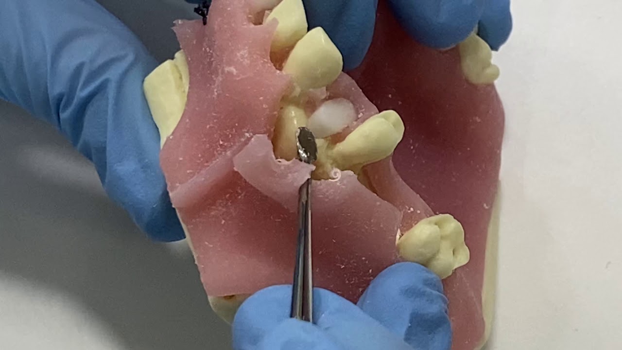 Practica de Exodoncia Qx RR14 - YouTube