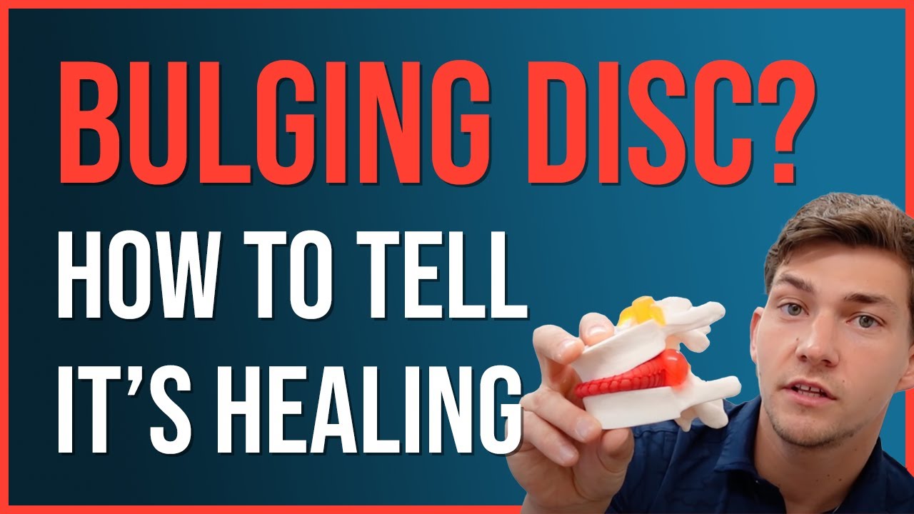 The WEIRDEST Sign a Bulging Disc is Healing! - YouTube