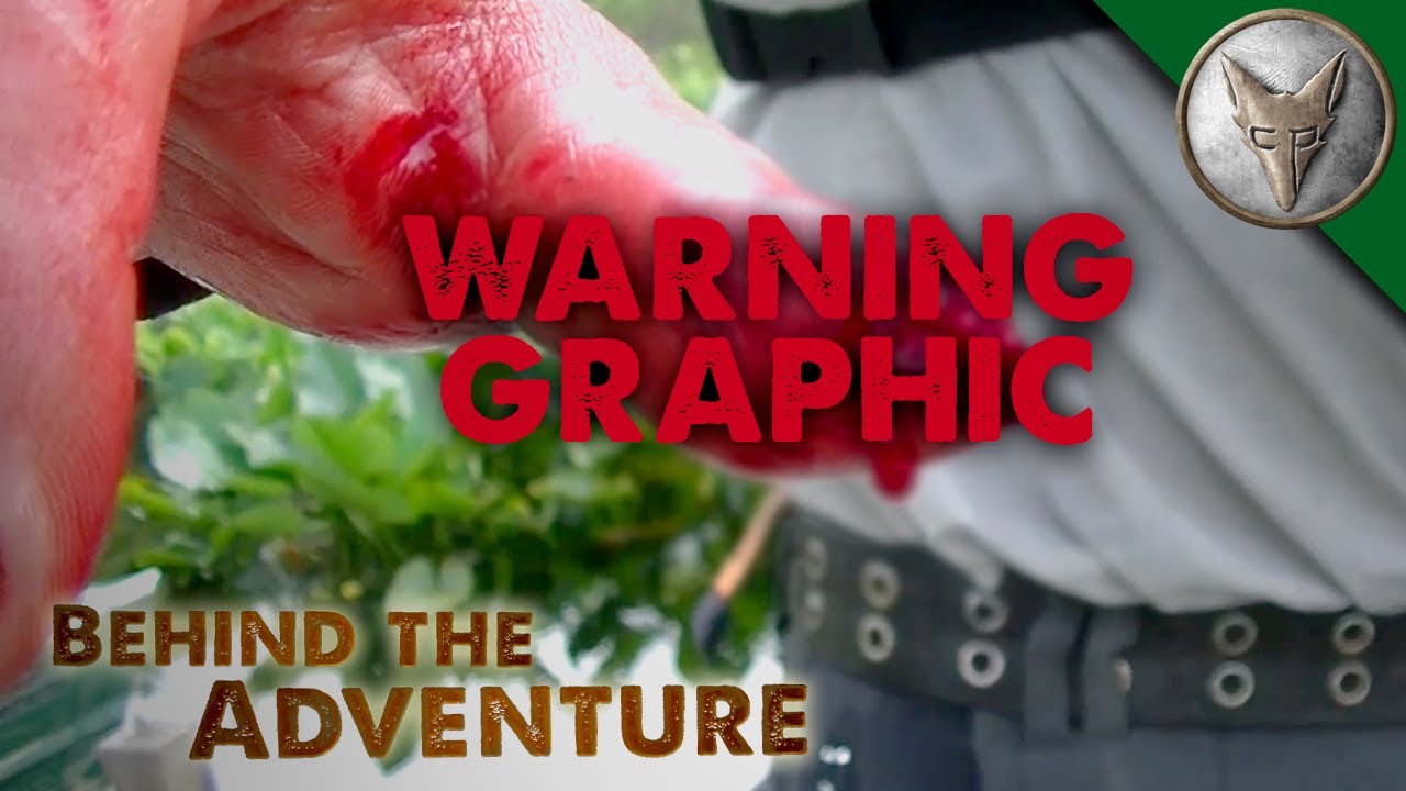 Brave Wilderness | REALLY BAD Snapping Turtle Bite - WARNING GRAPHIC ...