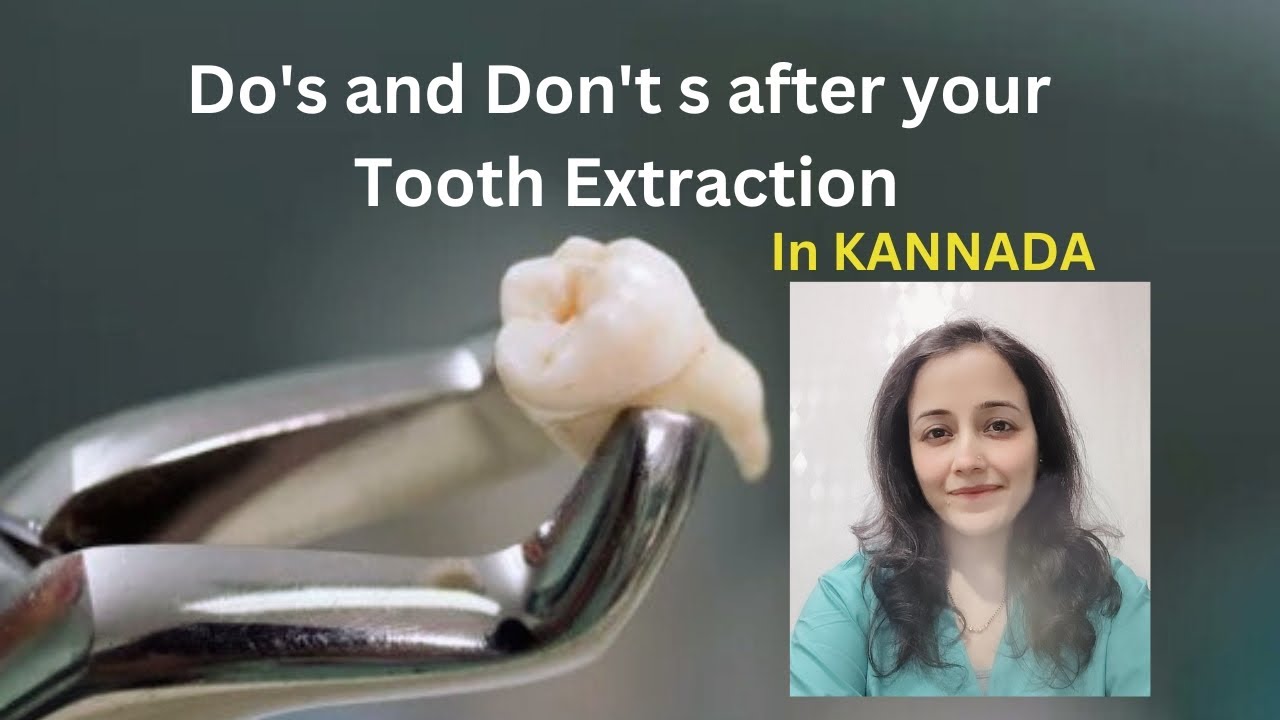 Post tooth extraction instructions| Dr Bharathi U | Your family ...