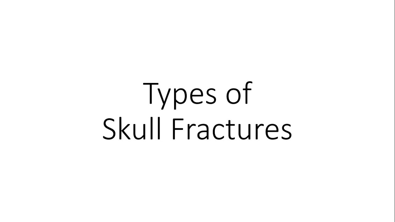 Types of Skull Fractures - Forensic Medicine (FMT) - YouTube