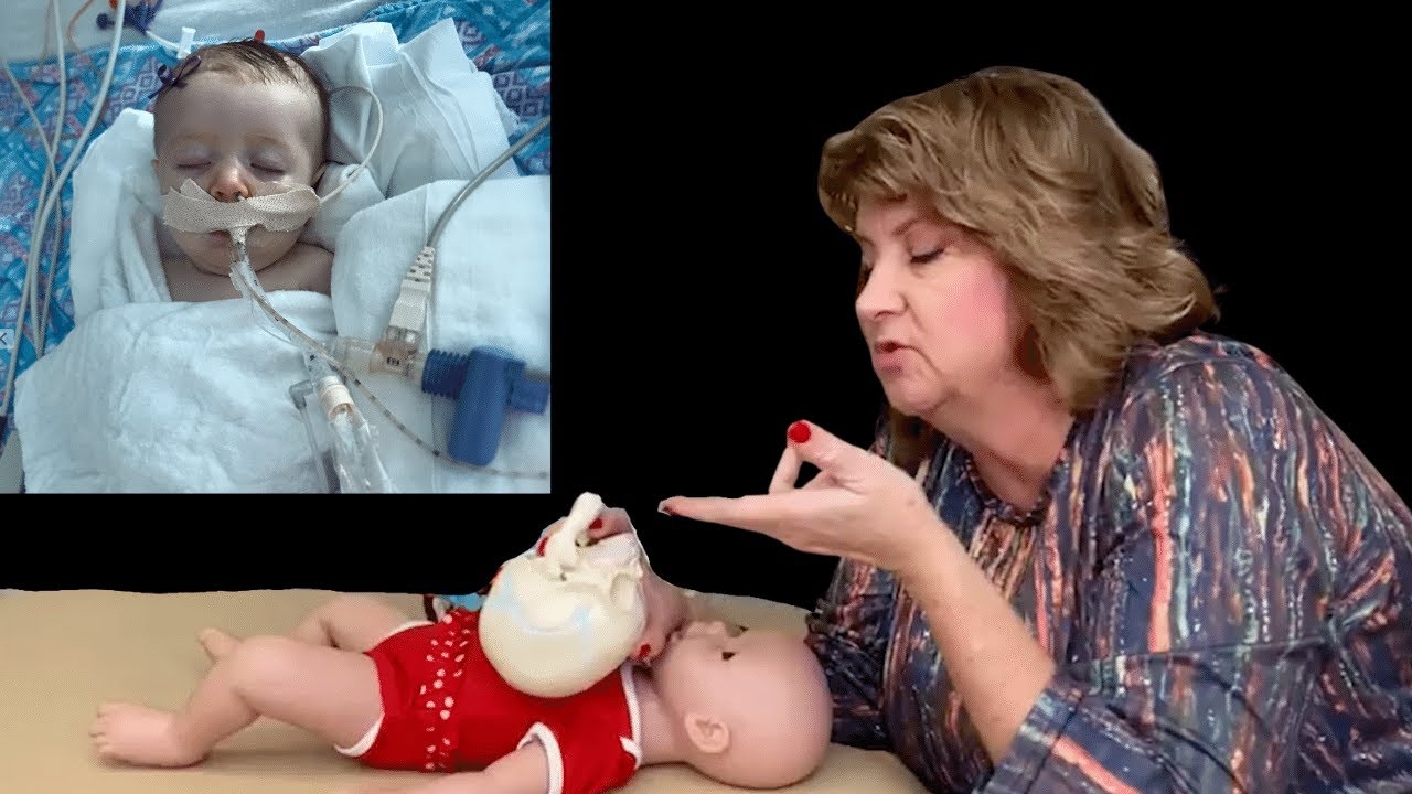 2 Ways Intubation, Feeding Tube (NG or NJ Tube), and / or NICU Time ...