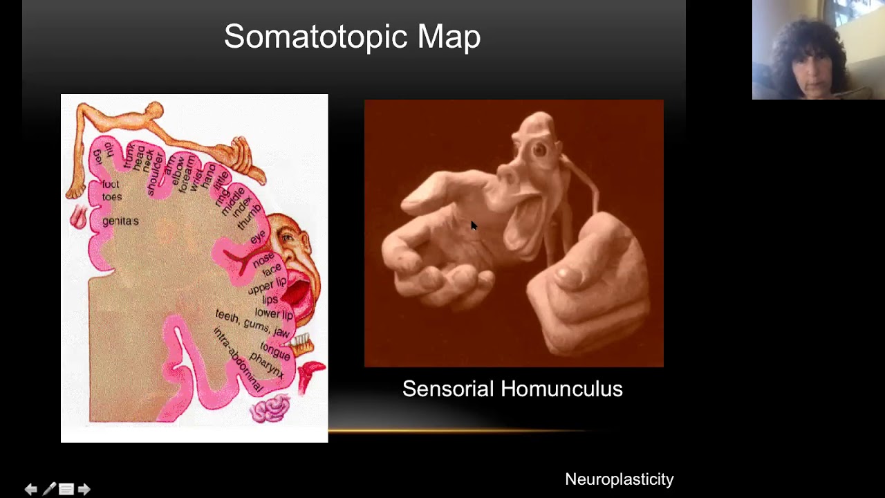 Posterior Cortical Atrophy Lecture Series with Rogerio Panizzutti, MD ...