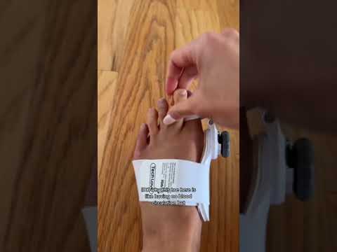 BUNION BRACE vs. TOE SEPARATORS? 🤧 #shorts