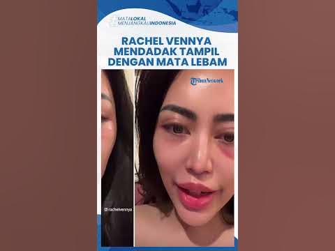 Rachel Vennya Tampil dengan Mata Lebam Buat Netizen Bertanya-tanya, Beri Klarifikasi Begini ...