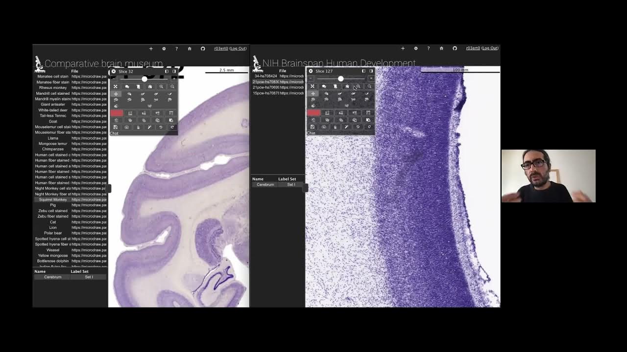 Distributed image analysis services using MicroDraw - YouTube