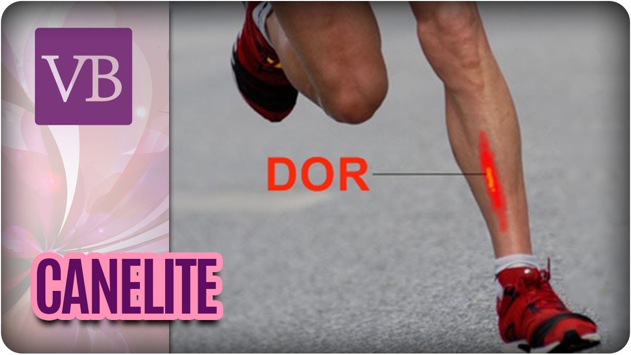 Canelite - Você Bonita (13/12/16) - YouTube