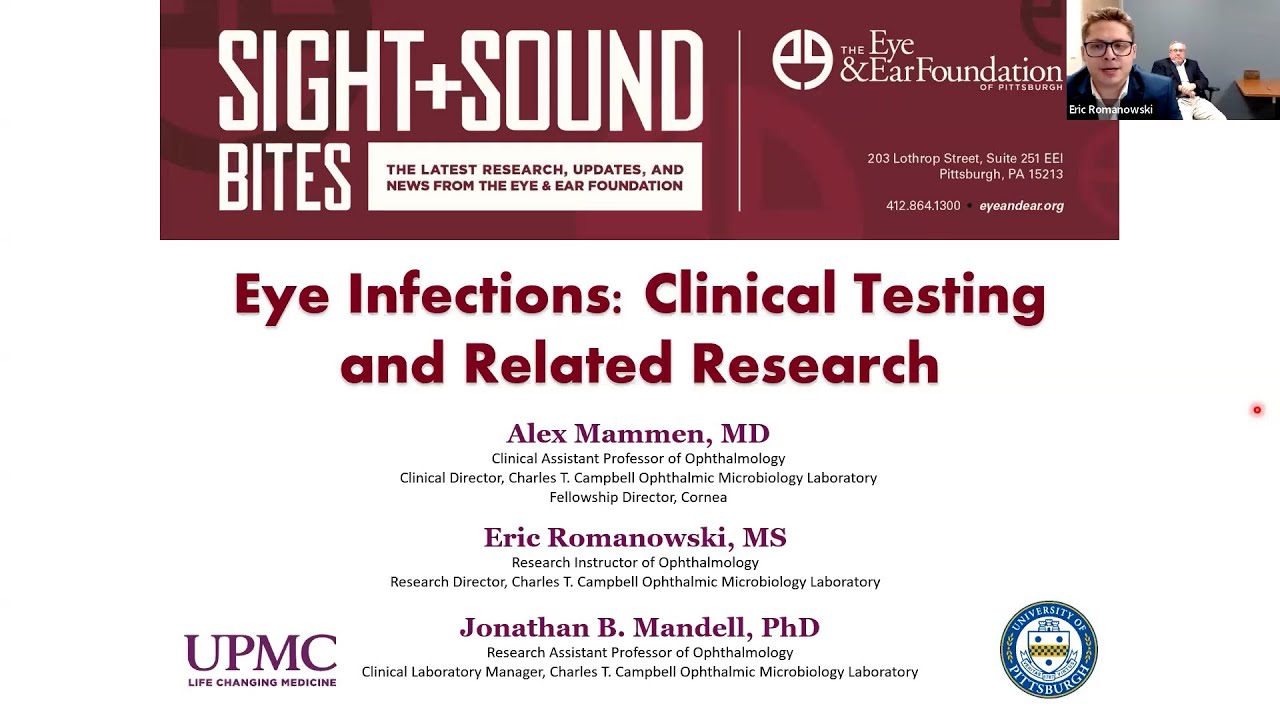 Sight + Sound Bites: Eye Infections - Clinical Testing and Related ...