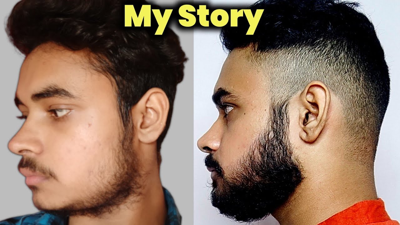 My Story Patchy Beard To Full Beard Naturally | Fix Patchy Beard ...