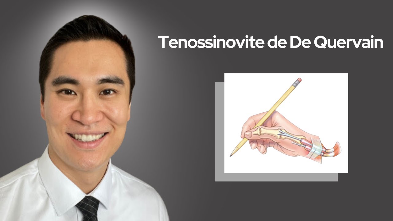 DOR NO PUNHO E POLEGAR? Pode ser TENOSSINOVITE DE DE QUERVAIN! (Guia ...