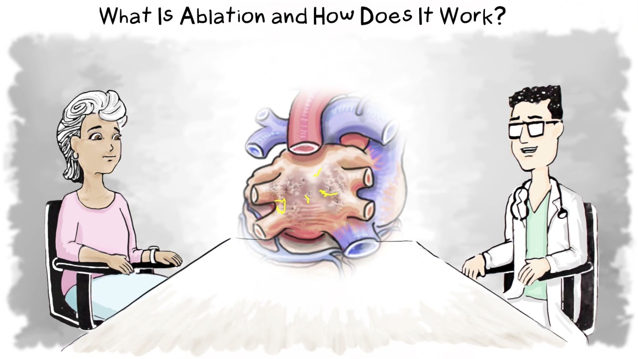 What is Ablation and What Does it Do - YouTube