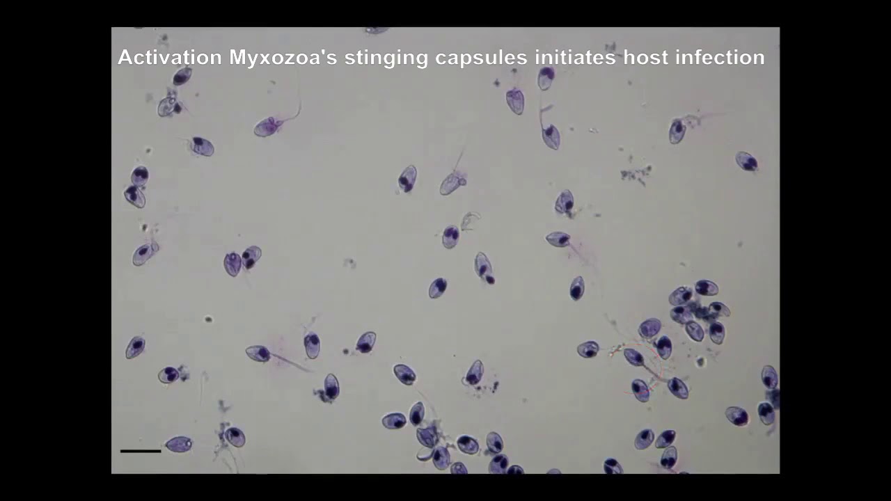 Myxozoa activation - YouTube