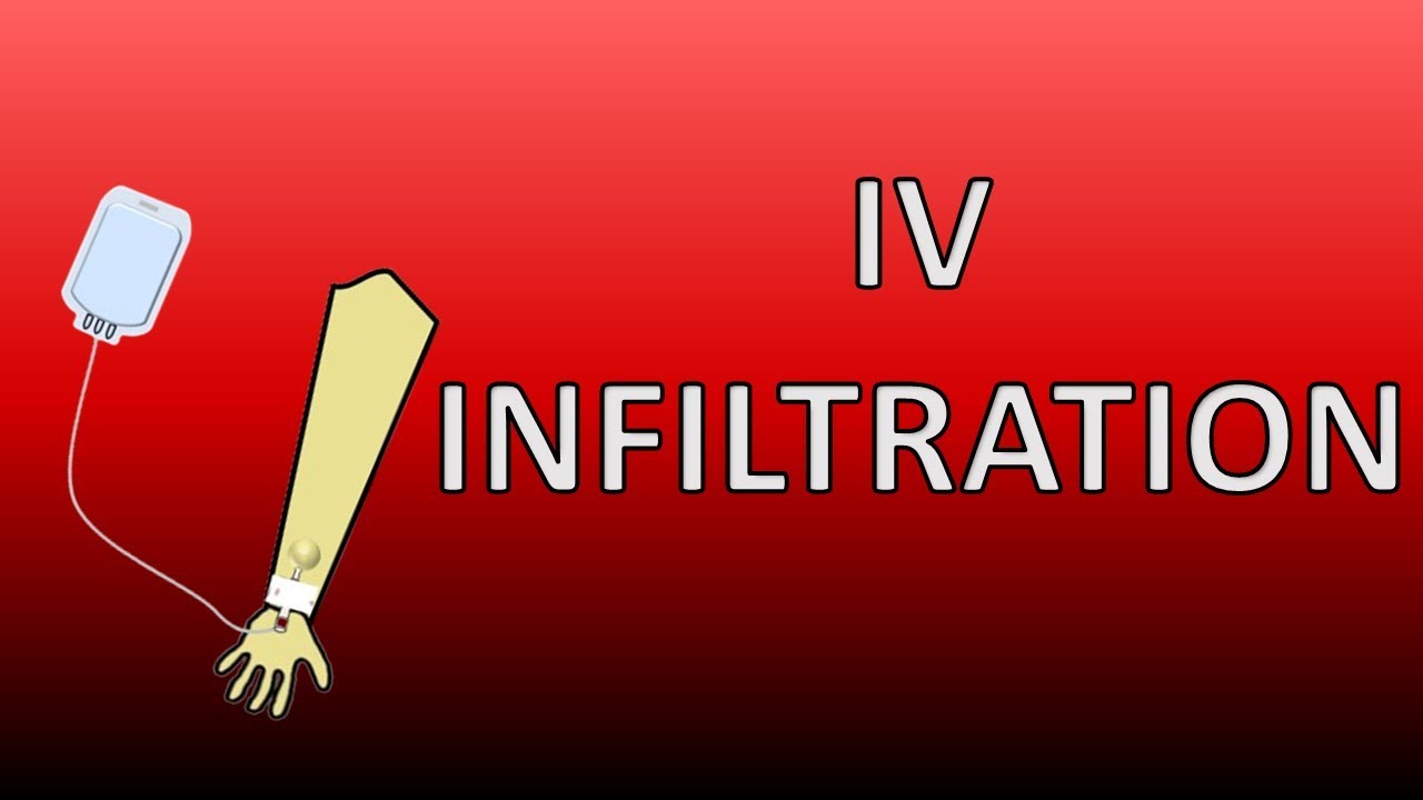 IV Infiltration (Leakage through insertion site) | Signs & Symptoms ...