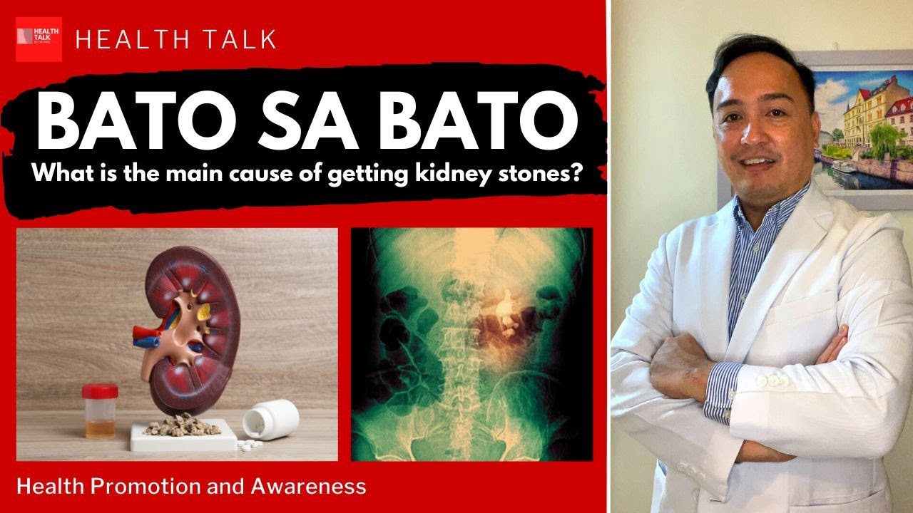 Kidney stones (Bato sa Bato): Causes, Symptoms and Prevention - YouTube