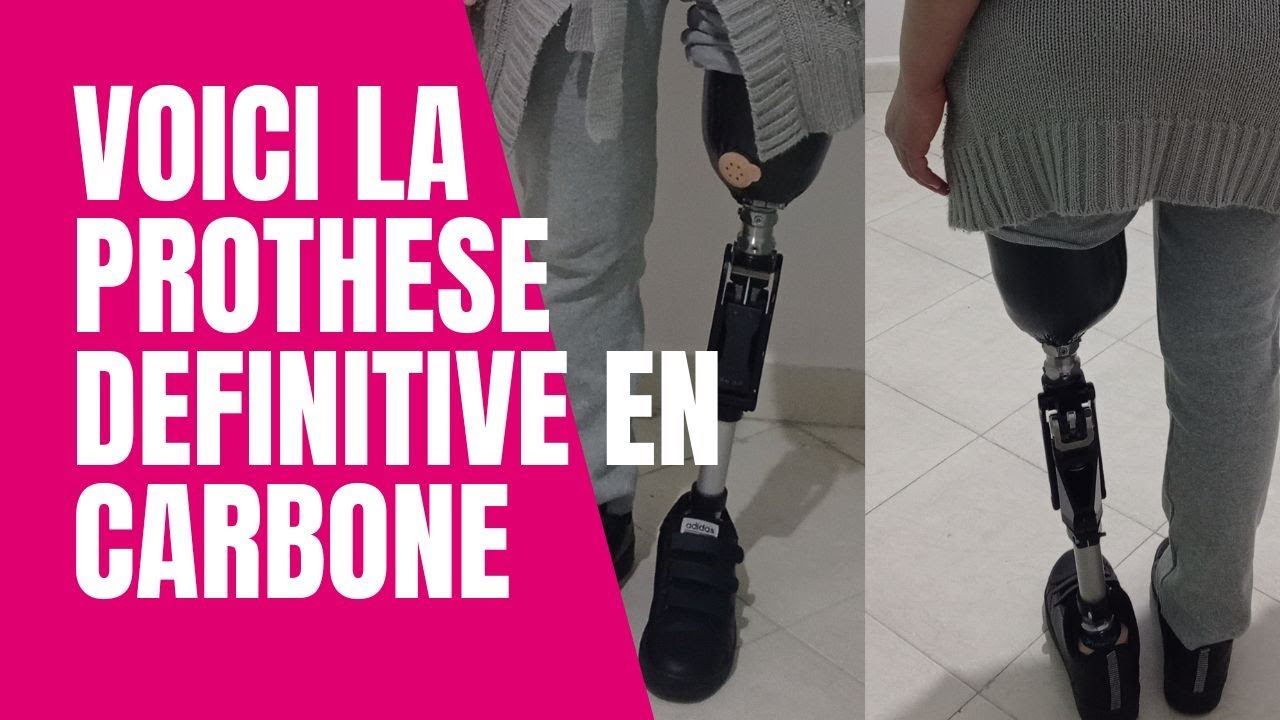 PROTHESE DEFINITIVE FEMORALE EN CARBONE 2/2. - YouTube