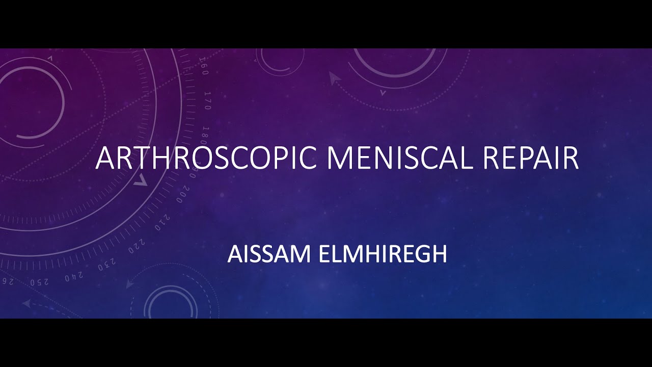 Arthroscopic Examination and repair of the medial meniscus - YouTube
