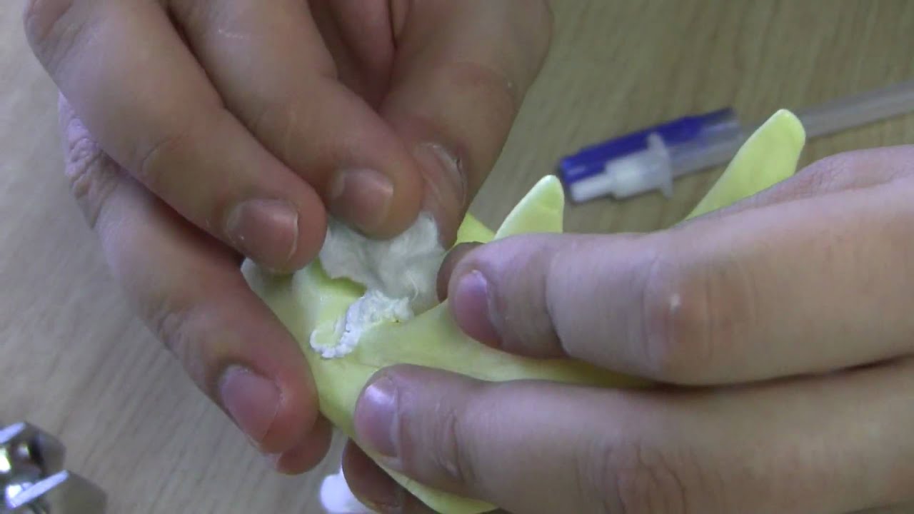 BondBone - Calcium sulfate bone graft material by Mis-Implants. - YouTube