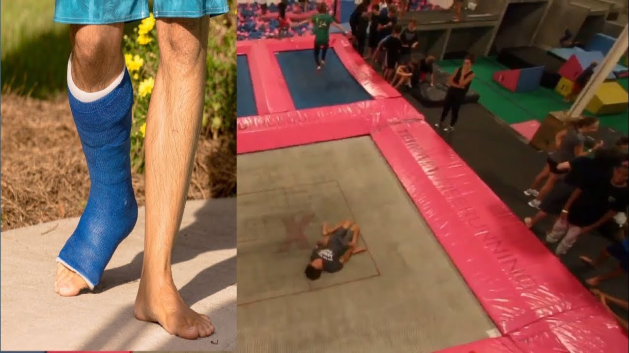 kid breaks leg after trying 6 flips (not clickbait) - YouTube
