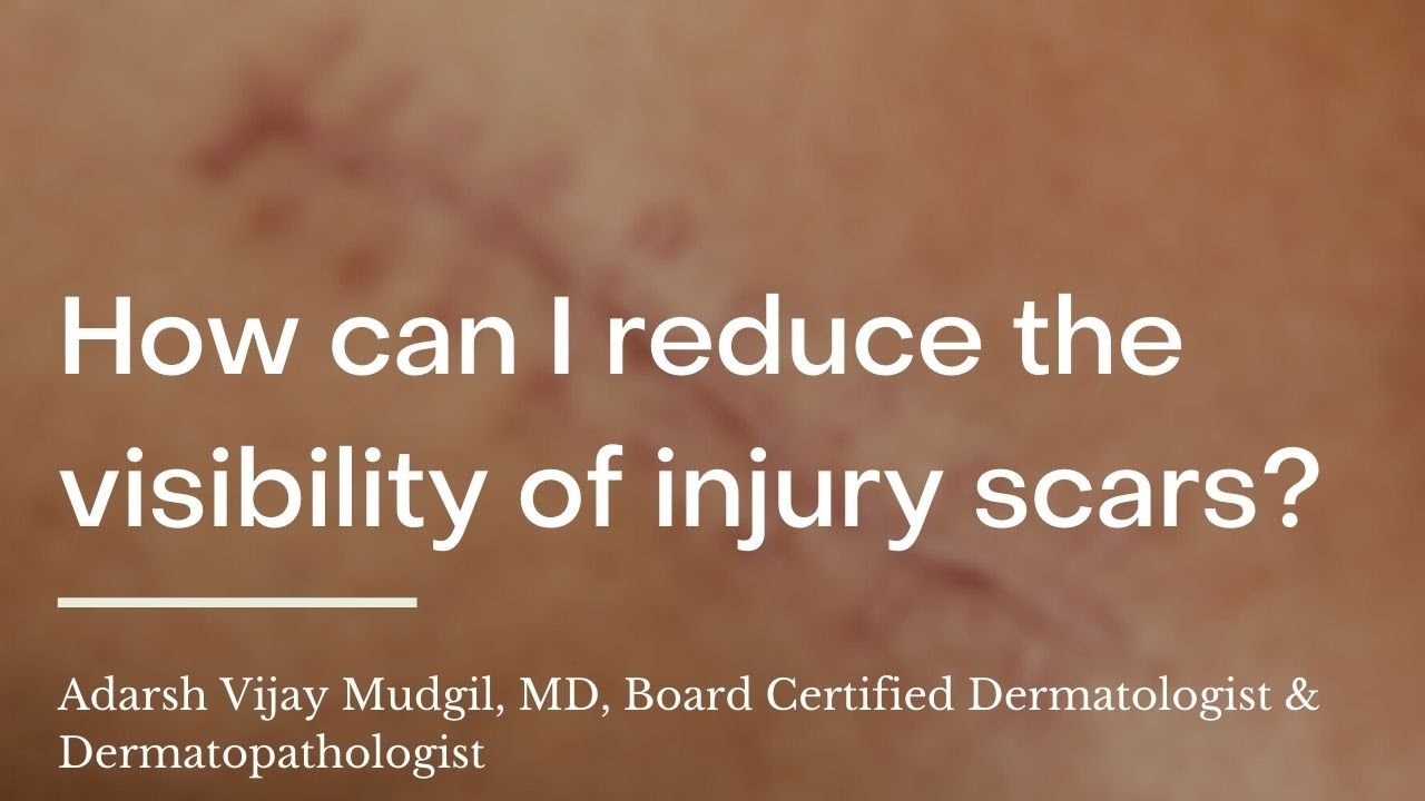 How Can I Reduce The Appearance Of Injury Scars? - YouTube
