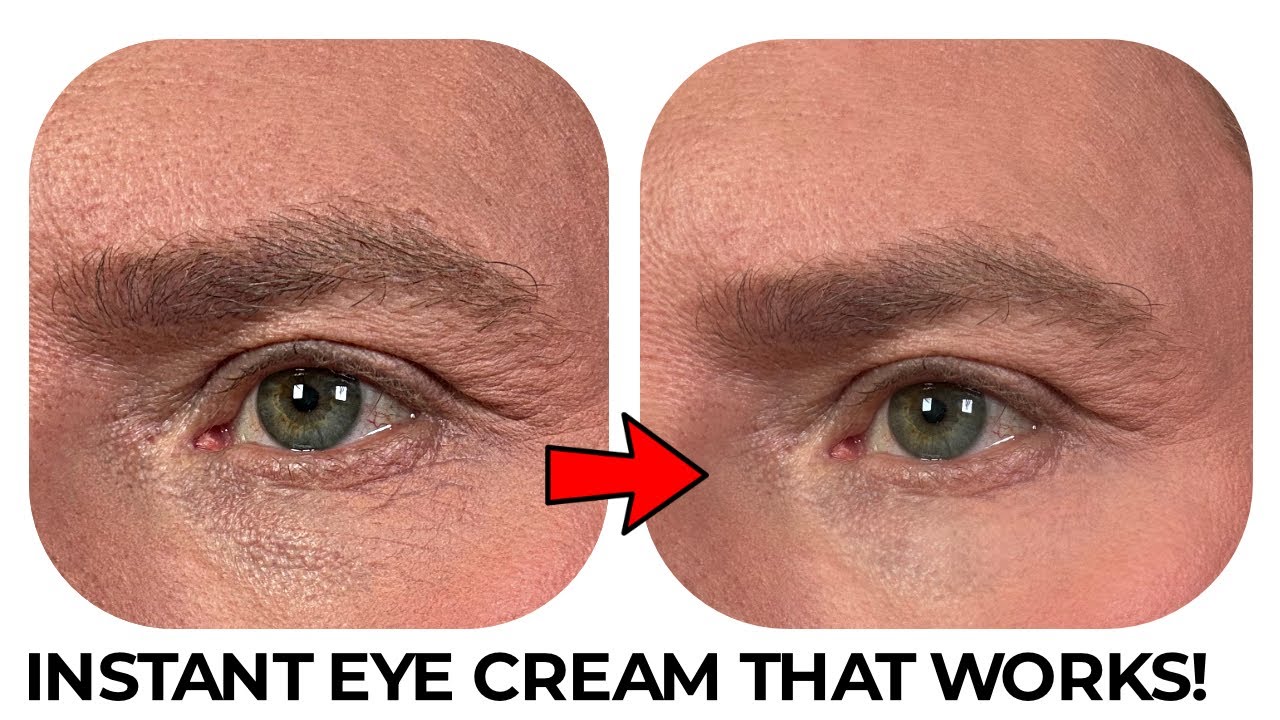 THE INSTANT EYE CREAM THAT WORKS IMMEDIATELY! - YouTube