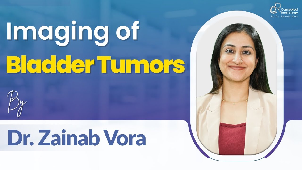 Bladder Tumor Imaging Simplified | VIRADS, Staging & Key Concepts by Dr ...