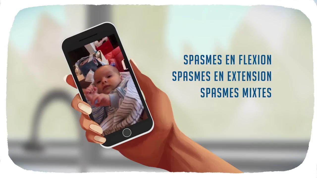 Les spasmes infantiles - YouTube