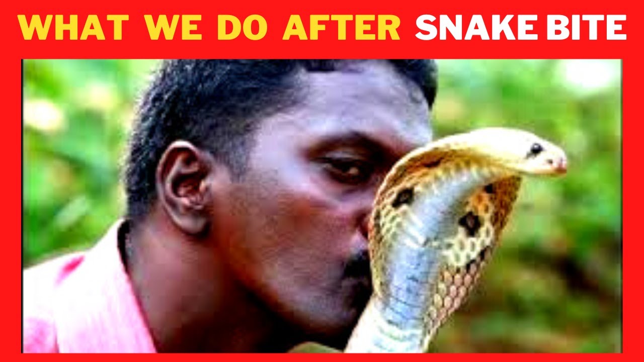 10 STEPS AFTER SNAKE BITE DO NOT BELIVE IN MOVEIS || FACTS || @ONLY FUN ...
