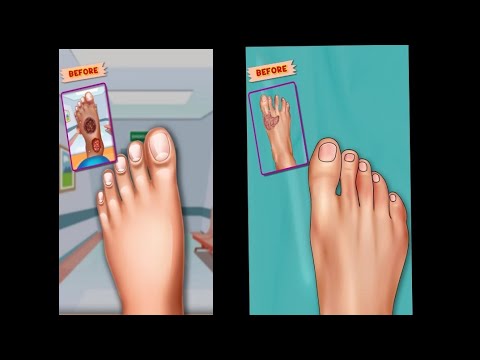 Game Sound Asmrasmr foot treatment, asmr foot surgery, asmr foot care ...