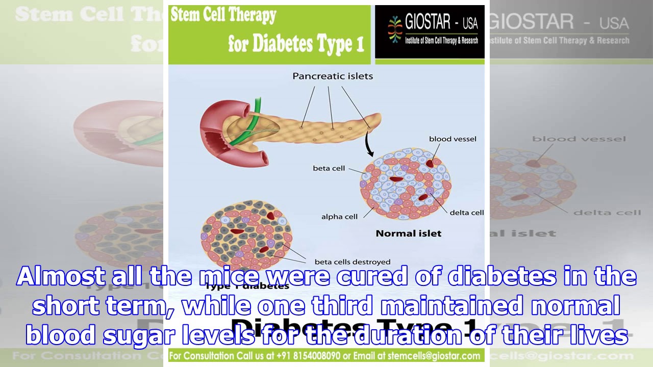 Scientists use stem cell therapy to reverse type-1 diabetes - YouTube