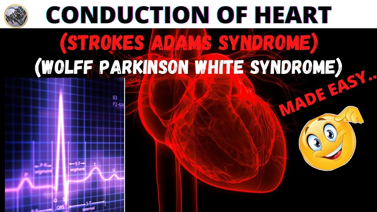 Conduction pathway of heart#strokes adams syndrome#WOLFF PARKINSON'S ...