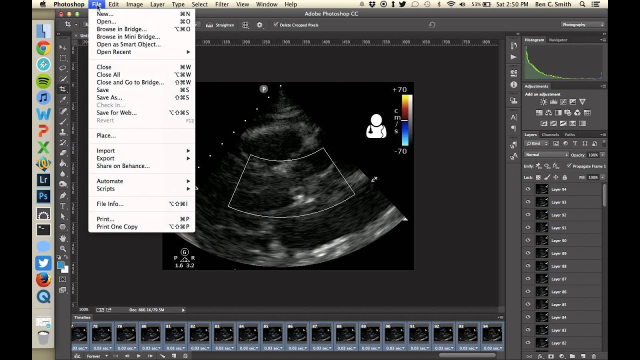 Tutorial: Create animated gifs from ultrasound clips - YouTube